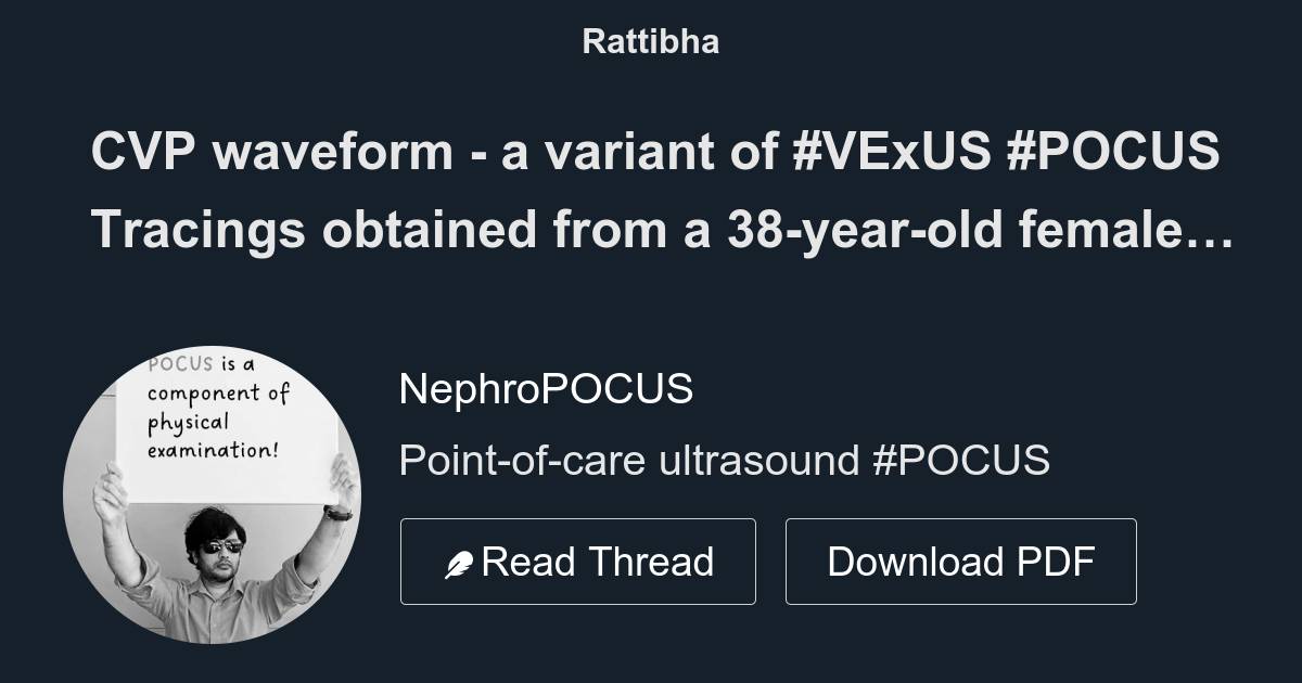 CVP waveform - a variant of #VExUS #POCUS Tracings obtained from a 38 ...