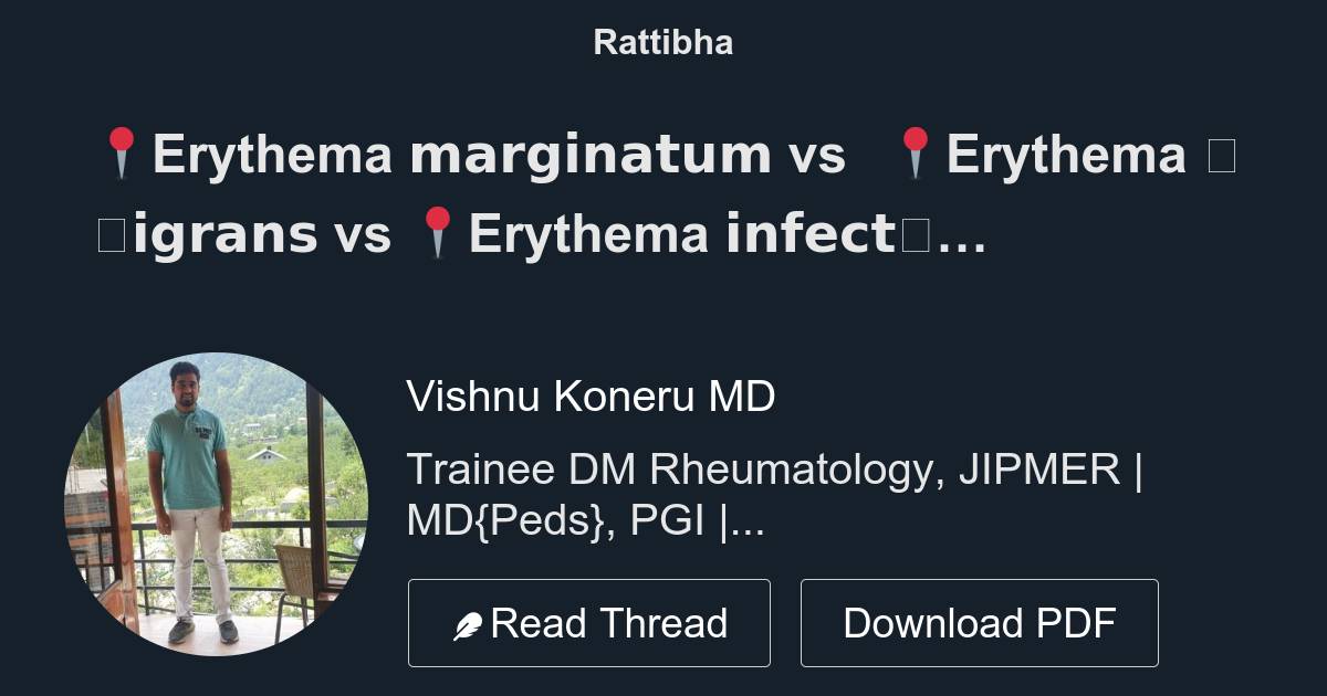 📍Erythema 𝗺𝗮𝗿𝗴𝗶𝗻𝗮𝘁𝘂𝗺 vs 📍Erythema 𝗺𝗶𝗴𝗿𝗮𝗻𝘀 vs 📍Erythema 𝗶𝗻𝗳𝗲𝗰𝘁𝗶𝗼𝘀𝘂𝗺 vs 📍 ...
